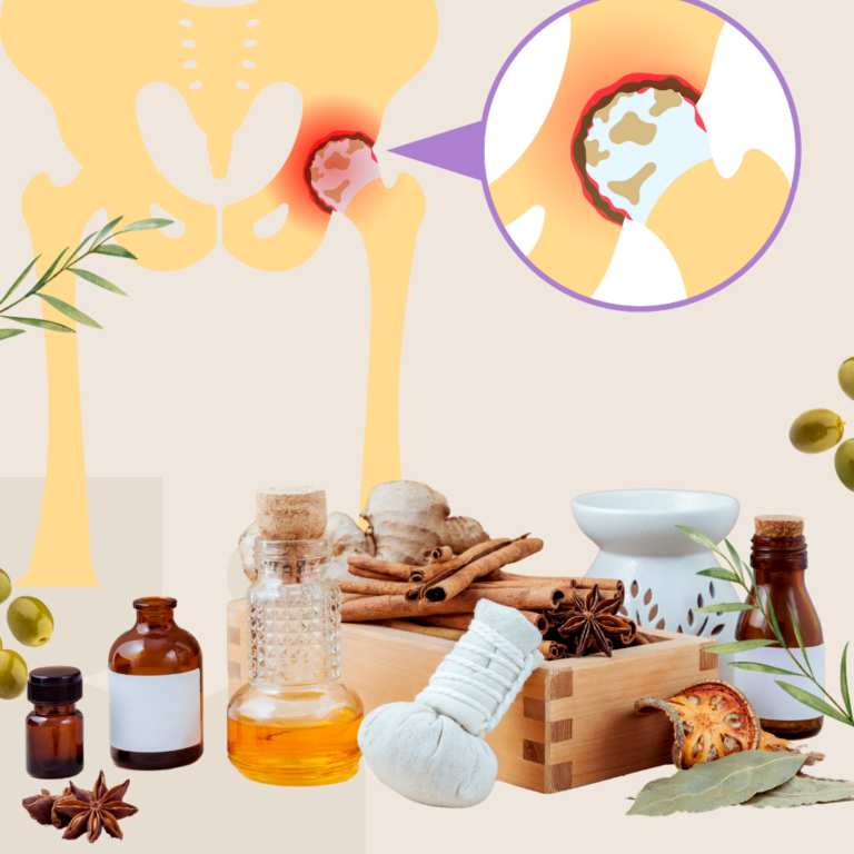 Avascular Necrosis Treatment in Noida | SKK Ayurveda